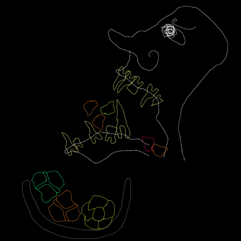 Teeth Simulator by bodro