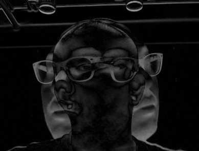cetaphobia by resting depressed face